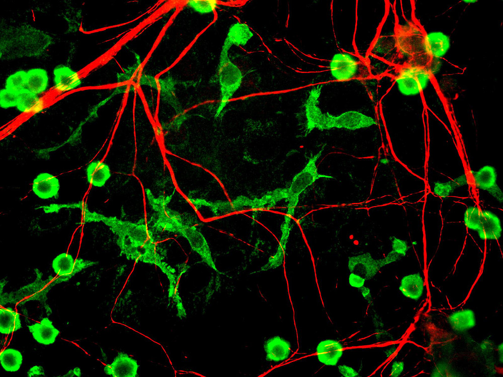 A Behind-the-Scenes Look at the Allen Institute and Open-Source Science ...